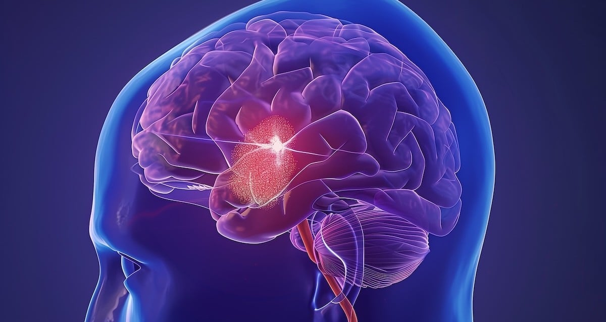 Study finds innovative surgery for small acoustic neuromas can preserve ...