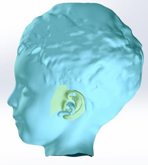 Changing lives one ear at a time - Hearing Practitioner Australia
