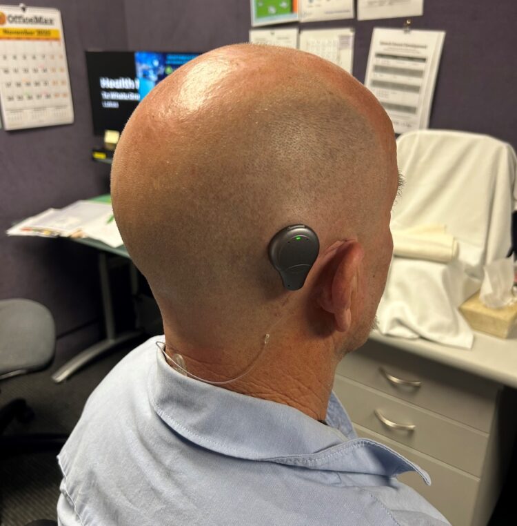 Oticon Medical's Sentio System: The smallest transcutaneous hearing ...